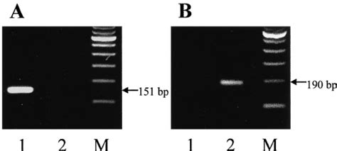 Detection Of Fusion Transcripts By Seminested Pcr Using Ssx1 Specific Download Scientific