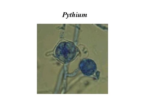 Eukaryotic Tree Of Life Fungi Are Polyphyletic F