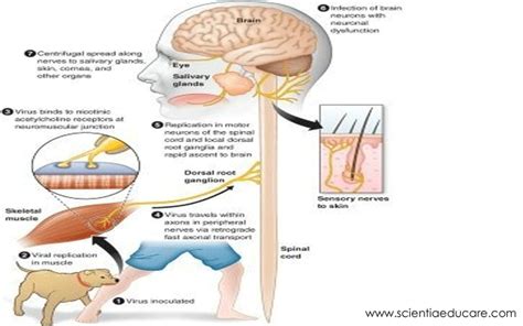 Rabies Is A Life Threatening Condition That Causes Tens Of