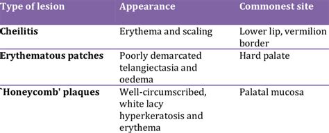 Clinical Characteristics Of Oral Lesions Seen In Lupus Erythematosus