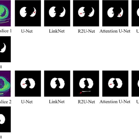 Examples Of Lung Segmentation Using Different Networks Download