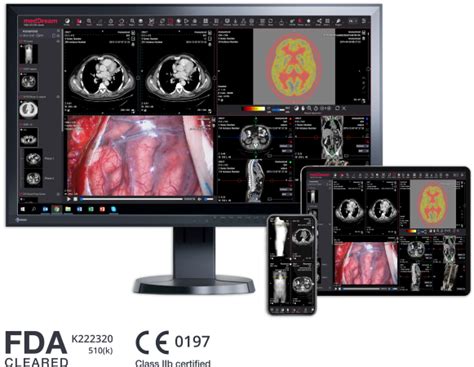 Dicom 3d Viewer Meddream