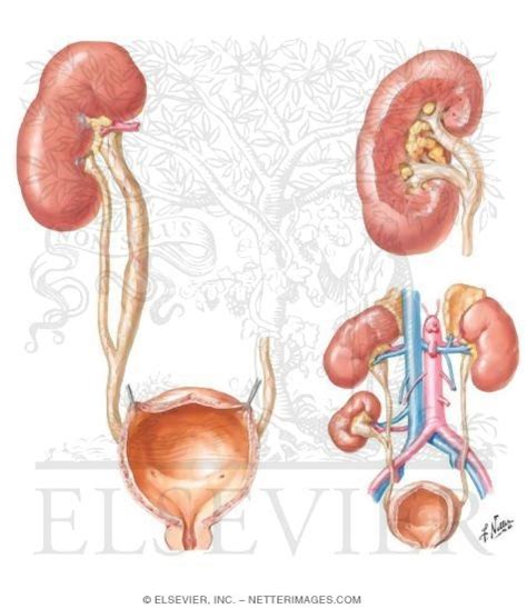 Ureteric Bud Duplication