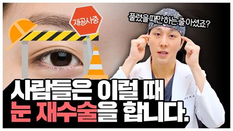 쌍꺼풀 수술이 잘못됐다 쌍꺼풀 눈재수술 전 이 시기를 놓치면 끝입니다 ⭐필수시청⭐ Youtube