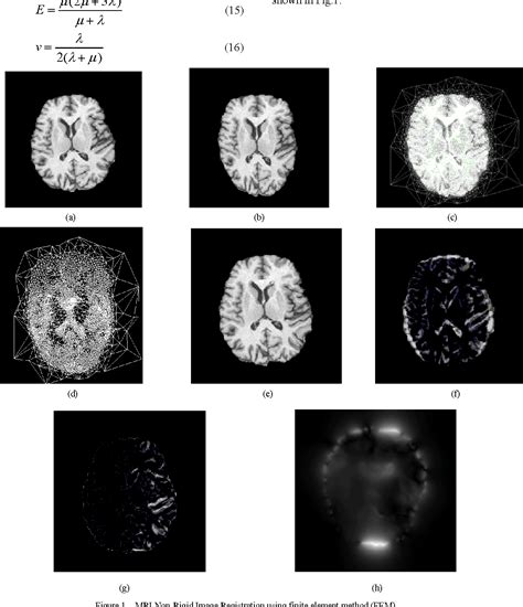 Figure 1 From A New Non Rigid Image Registration Algorithm Using The Finite Element Method