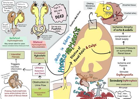 Hydronephrosis Dilated Pelvis And Calyx Creative Med Doses