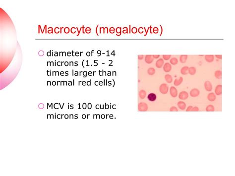 Red Cell Morphology Laboratory Medicine Department Saudi German