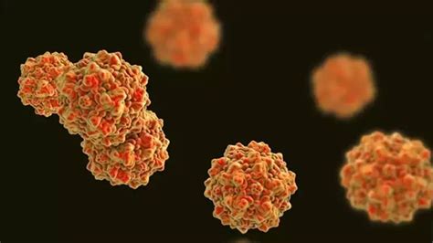 Պարվովիրուսային վարակ պատճառներ Մեդեքս