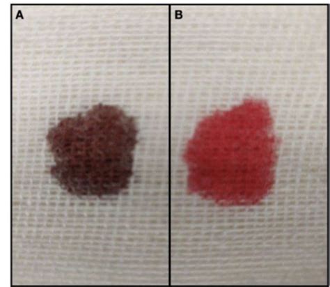 Exam 1 Erythrocytes Production Function Destruction Flashcards Quizlet