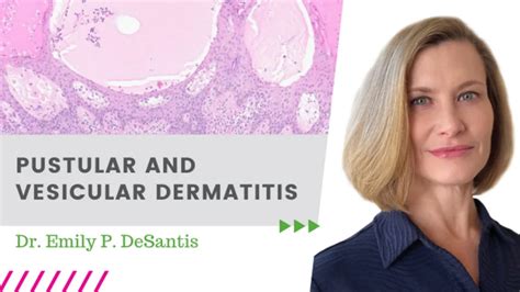 Dermpath Educational Library Sagis
