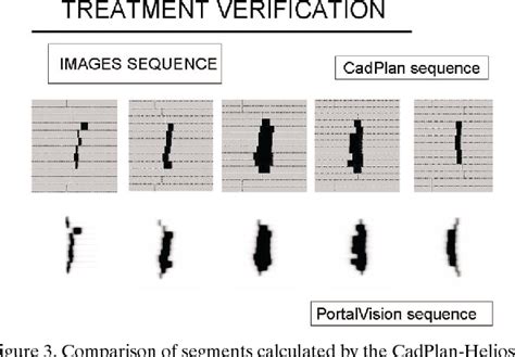 Figure 1 From IMRT In Clinical Practice Introduction Of New QA Procedures Semantic Scholar