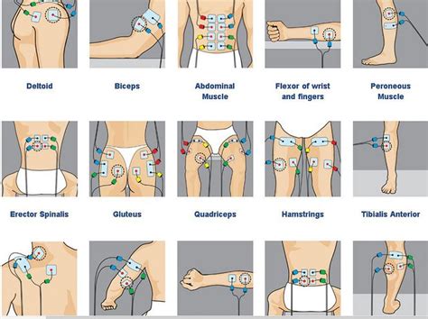 Electronic Assist For Human Body Tens Unit Placement Physical