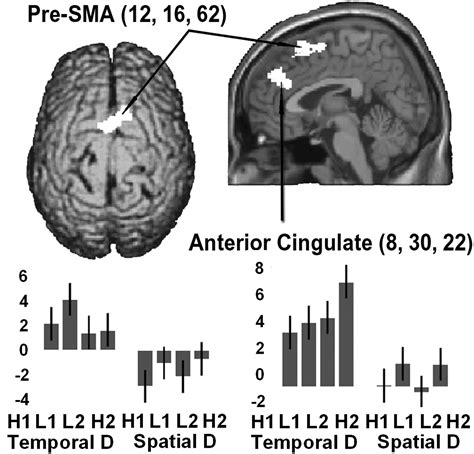 The Functional Neuroanatomy Of Temporal Discrimination Journal Of Neuroscience