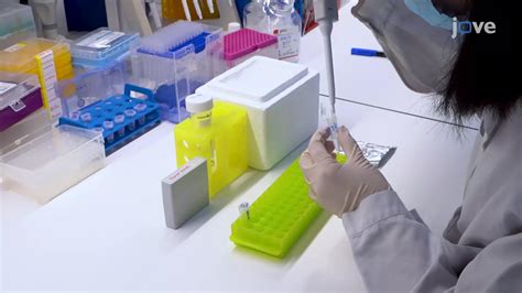 Amplified Luminescent Proximity Homogeneous Assay A Bead Based