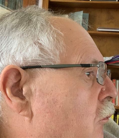 Eye Checkup Thoughts On Interactions Between Mind… By Dr John