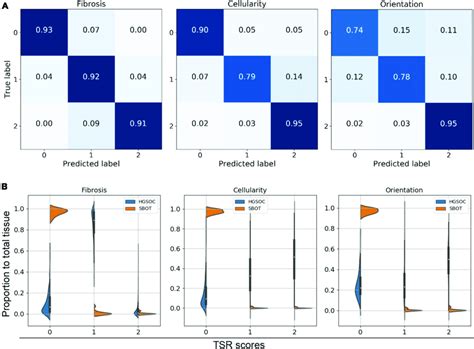 Tumor Stroma Reaction Tsr Scoring Evaluation A Confusion Matrix Of