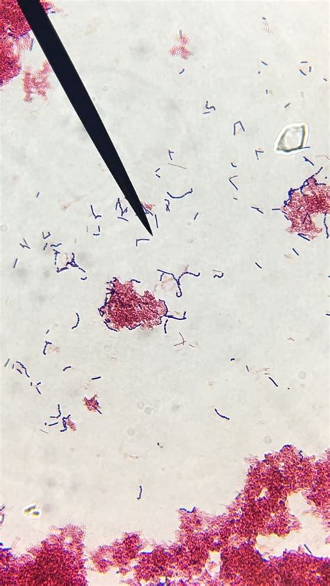 Lactobacillus Diagram