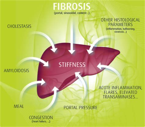 SMART SCAN Fibroscan Liver Elastography And CAP Scan Gastrointestinal And Liver Clinic
