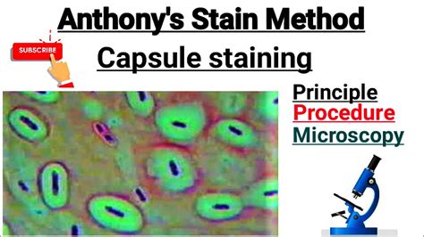 Capsule Staining Procedure Anthonys Stain Method Part 7 Youtube