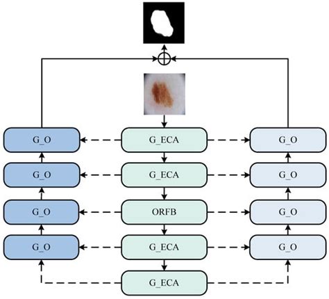 Dtonet A Lightweight Model For Melanoma Segmentation