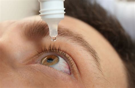 Best Eye Drops For Pink Eye Conjunctivitis