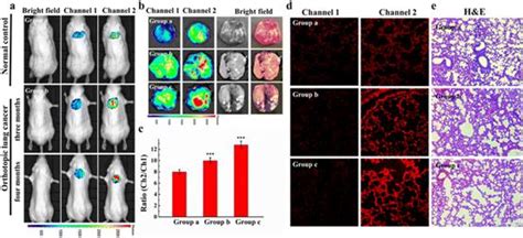 Fluorescence Probes For Lung Carcinoma Diagnosis And Clinical Application 功能材料与分子影像技术创新