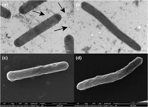 Electron Microscopic Analysis Of C Difficile 630 Δerm And C Difficile