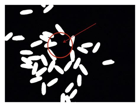Comparison Of Images Before And After Morphological Filtering A The