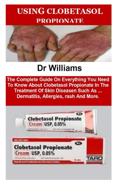 Using Clobetasol Propionate The Complete Guide On Everything You Need To Know About Clobetasol