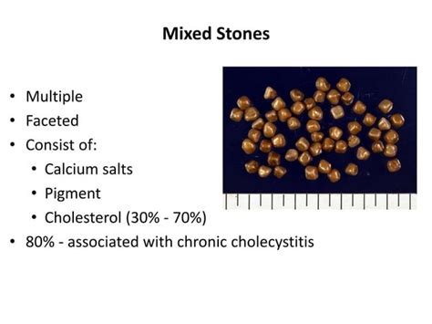 Cholecystits Classification Symptomsppt