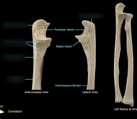 Proximal Ulna Diagram Quizlet