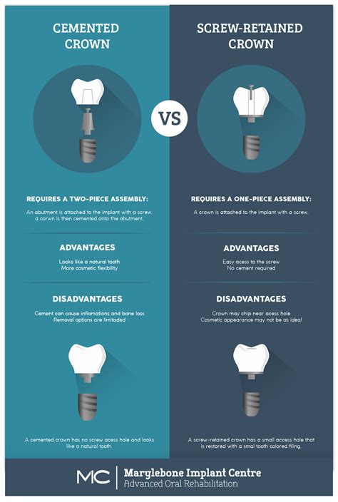 Dental Implant Crown