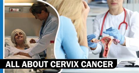 All About Cervix Cancer