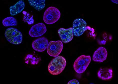 Ai And Drug Discovery Data Access Remains A Huge Challenge