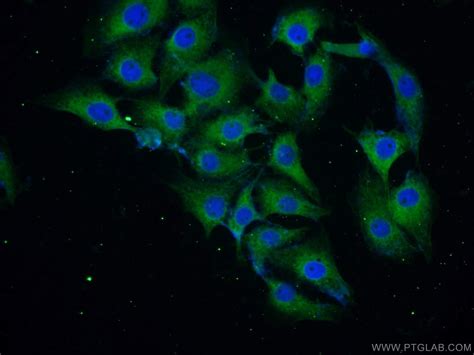 Alpha Synuclein Antibody 10842 1 Ap Proteintech