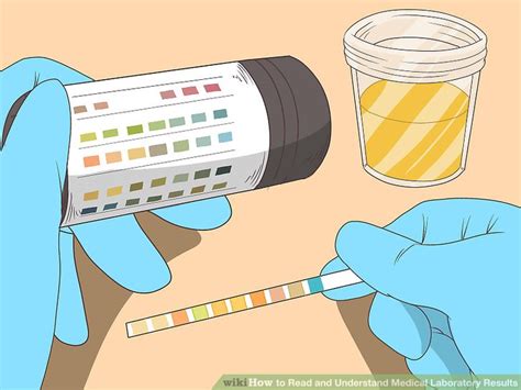 How To Read And Understand Medical Laboratory Results Steps