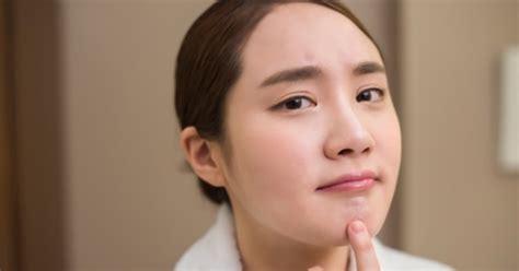 생리 전후 악화되는 턱여드름의 원인와 치료