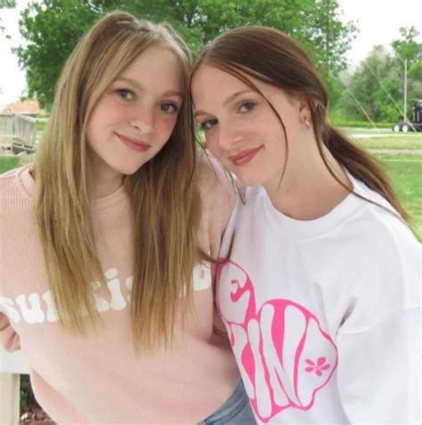 داستان دوقلوهای به هم چسبیده که با موفقیت از هم جدا شدند