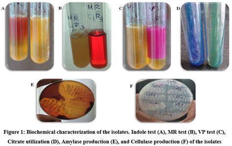 Isolation And Characterization Of Rhizobium From Green Gram Vigna