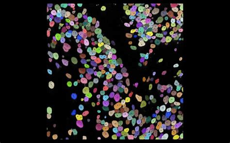 Nuclei Segmentation With Qupath Sam Plugin Usage And Issues Imagesc Forum