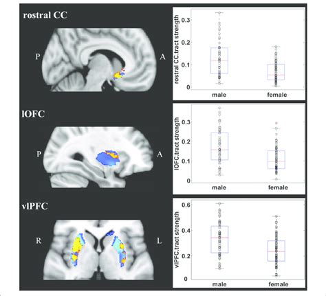 Stronger Fiber Connection In Males Than In Females Fiber Connections Download Scientific