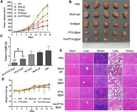 Combined Thermosensitive Gel For Local Chemotherapy Ijn