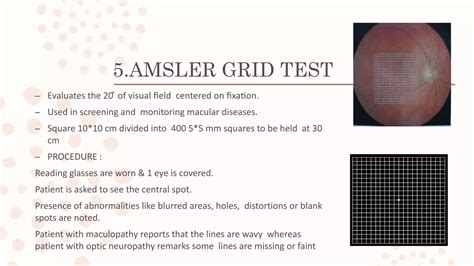Macular Function Test Pptx