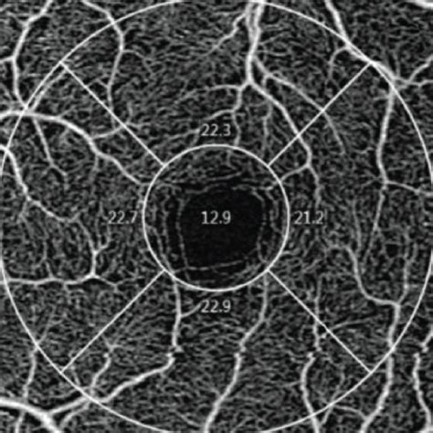 A Retinal Segmentation At Optical Coherence Tomography Oct Download Scientific Diagram