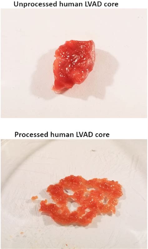 Figure 1 From Isolation Of Macrophage Subsets And Stromal Cells From