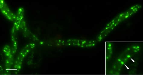 Fluorescence Microscopy Observation Of Live Bacteria Inside The Fungal