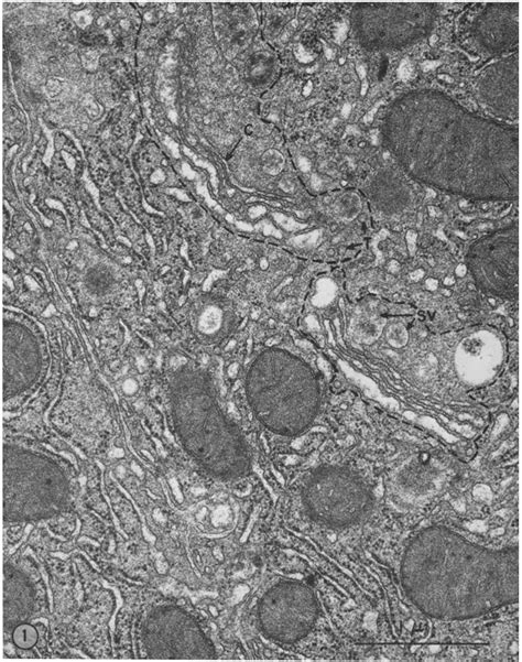 Electron Micrograph Of Rat Hepatocyte Cytoplasm Showing The Golgi