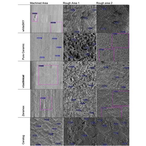SEM For Localization Of EDX Analysis Download Scientific Diagram
