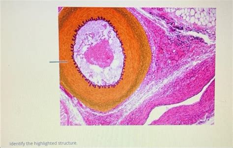 Solved Identify The Highlighted Structure Identify The