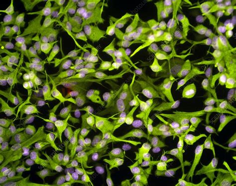 Astrocyte Brain Cells Light Micrograph Stock Image C010 3070 Science Photo Library